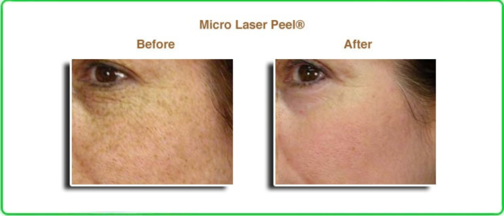 Prevention of Preterm Birth - KindCare Medical Center